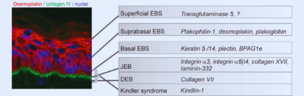 EB in detail - Cure EB